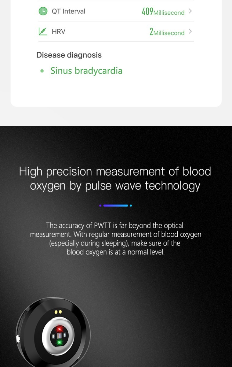 W3 Smart Watch Bluetooth Call Blood Pressure Heart Rate Fitness Tra